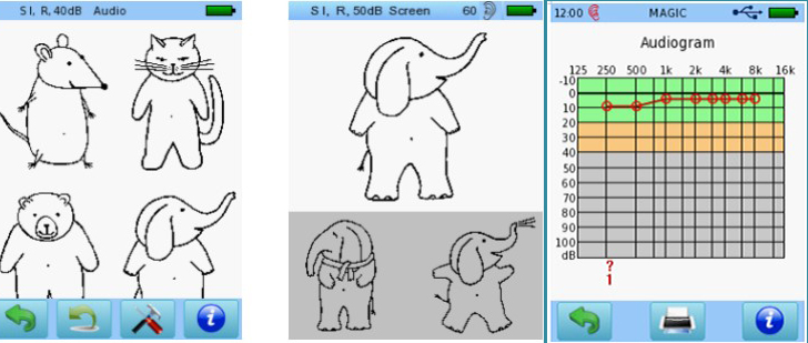 Diagnostics of hearing in children, audiometry, VSWP, impedance ...